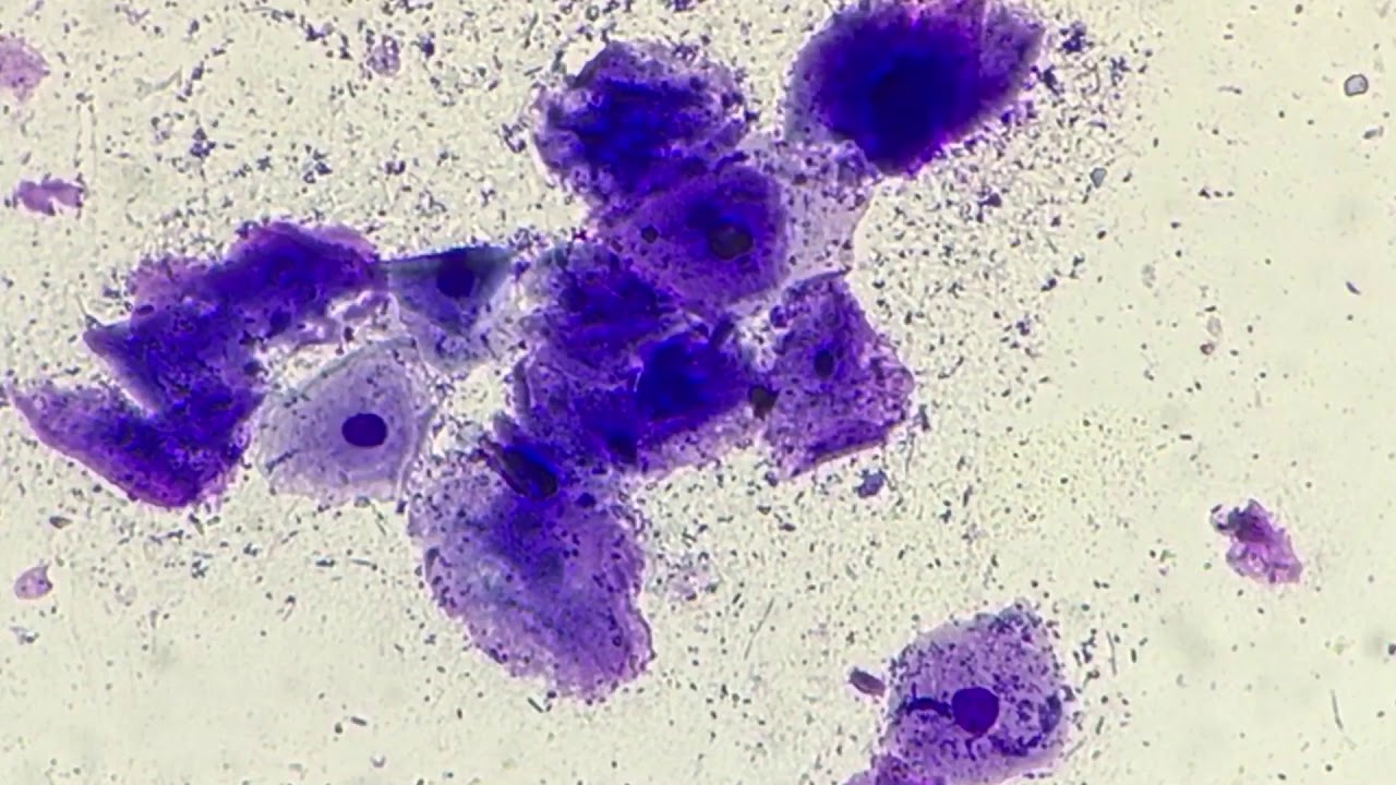 Vaginal cytology smear